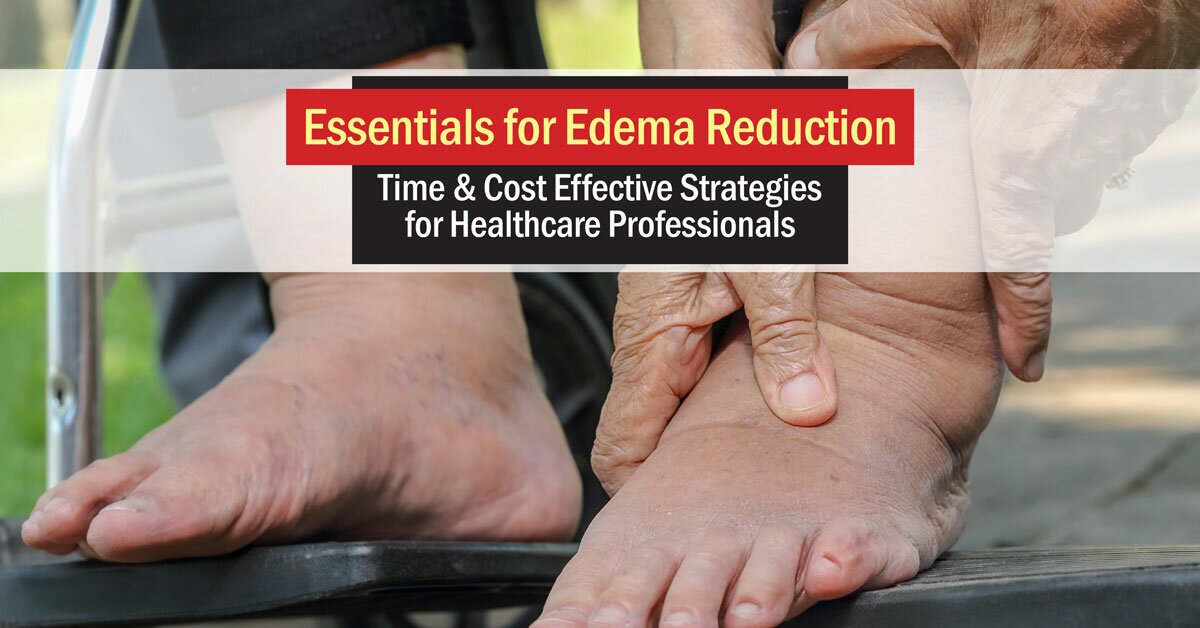 Essentials for Edema Reduction--Time & Cost Effective Strategies for ...